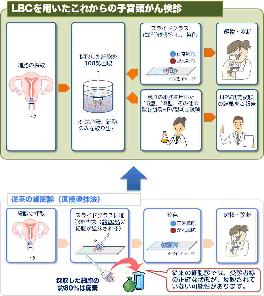 子宮頸がんにおける液状細胞診とHPV核酸検出検査（簡易ジェノタイプ判定） - ユーロフィン