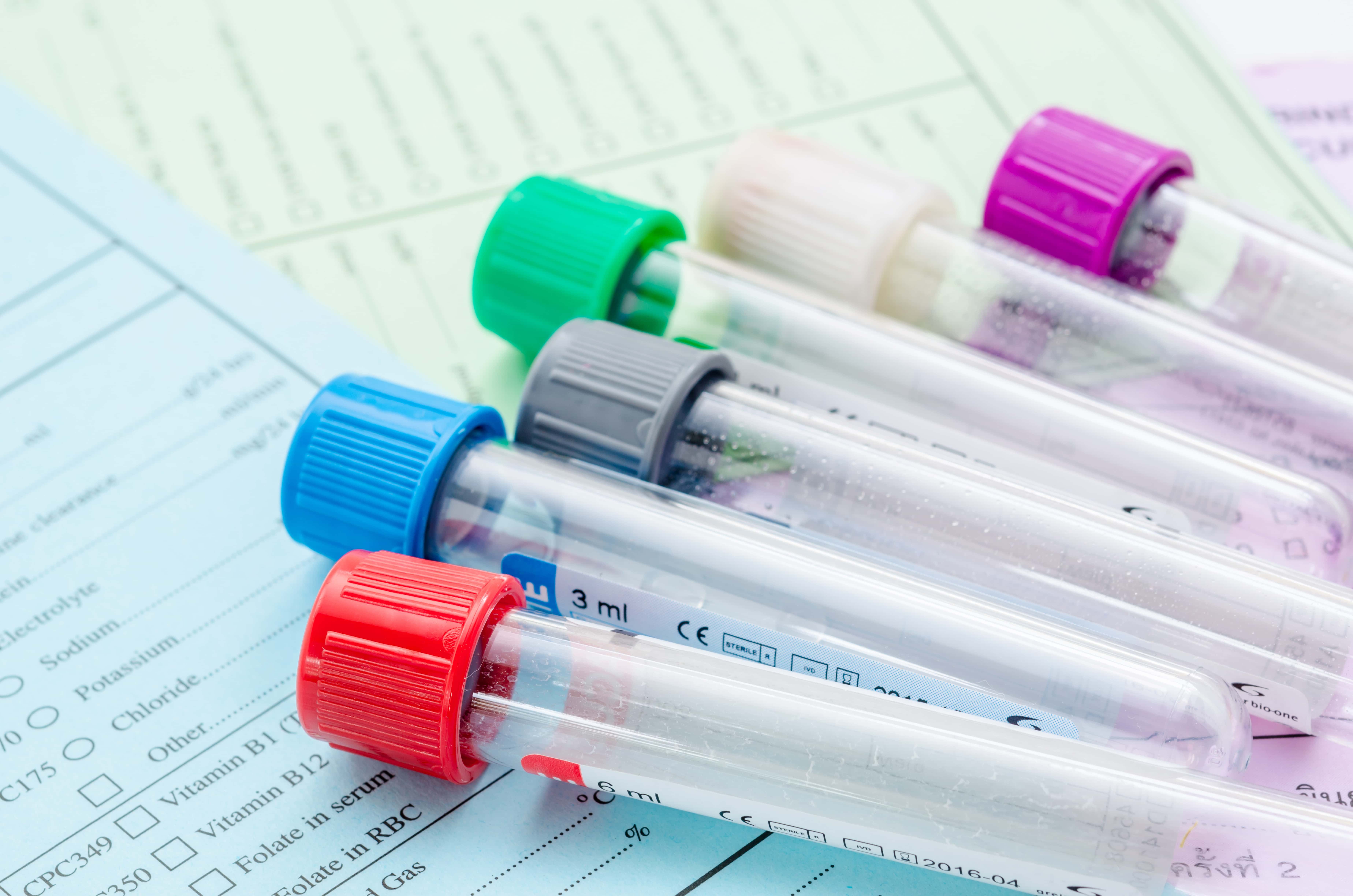 Specimen Collection Handling Guidelines Eurofins Scientific